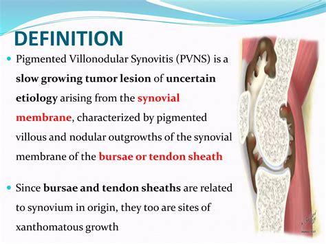 Pigmented Villonodular Synovitis Pptx