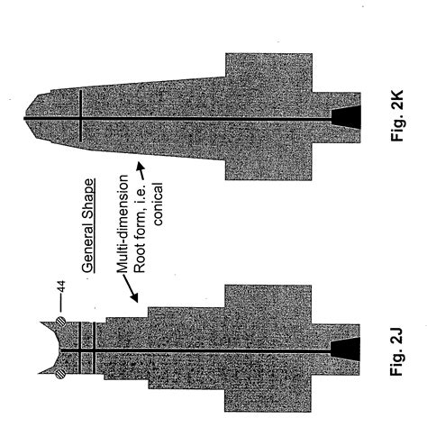 Maxillarysinus 千图网