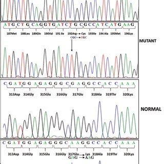 A Electropherogram Showing The Normal And RCM I Pathogenic Homozygous Download Scientific