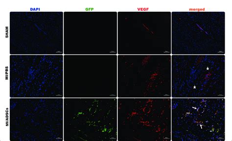 Vegf And Gfp Staining In Tissue Sections From Rabbit Heart Tissues In