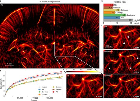 2d Ulm Density Based Renderings Of ‘in Vivo Rat Brain Perfusion With 2d Ulm Density Based Renderings Of ‘in Vivo Rat Brain Perfusion With
