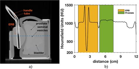 left image of a ct of the prostate training phantom cirs model 070 l