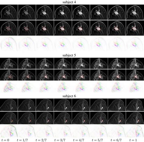 Each Block Of Three Row Images Presents Top Example Slices Of Dce Download Scientific Diagram