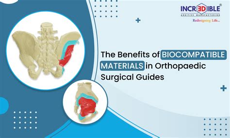 The Benefits Of Biocompatible Materials In Orthopaedic Surgical Guides