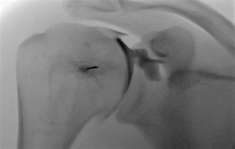 Fluoroscopy Omr