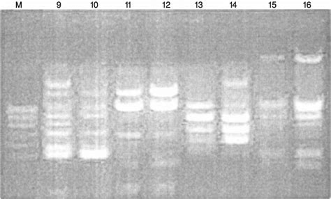 Primer Section Pcr Amplification Products Directed By 14 Different
