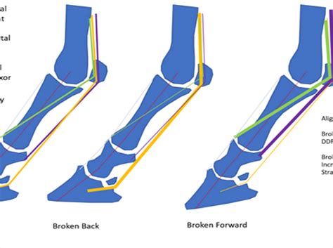 The Effect Of Digit Alignment On The Soft Tissue Structures Of The
