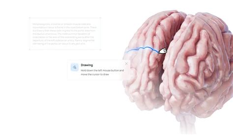 Voka 3d Anatomy And Pathology Medically Accurate And Interactive