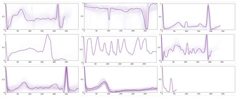 Prototype Learning For Medical Time Series Classification Via Human