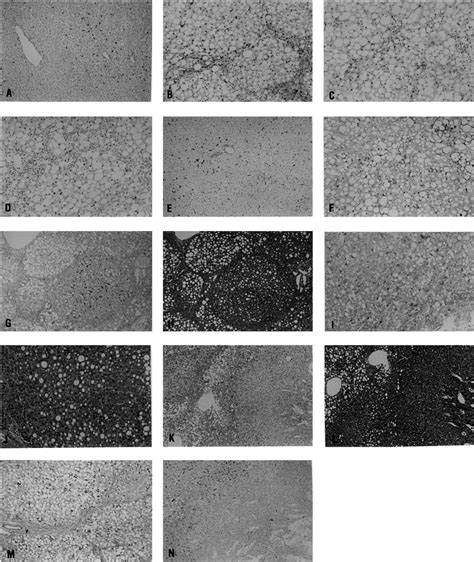 Immunohistochemical Findings For COX 2 A B C G I And K And COX 1 Download Scientific