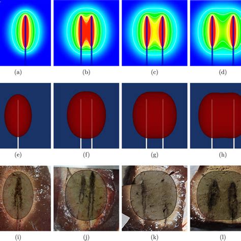 Results Of The Computed Temperature Fields 3d Simulated Ablation Zones Download Scientific