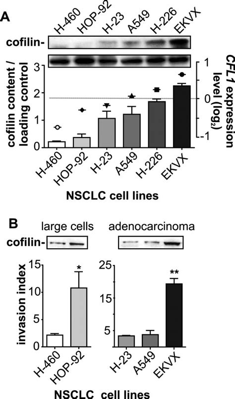 Cfl1 Expression Levels As A Prognostic And Drug Resistance Marker In