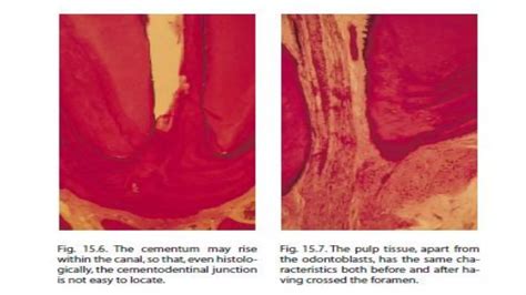 Internal Anatomy Classification Pdf