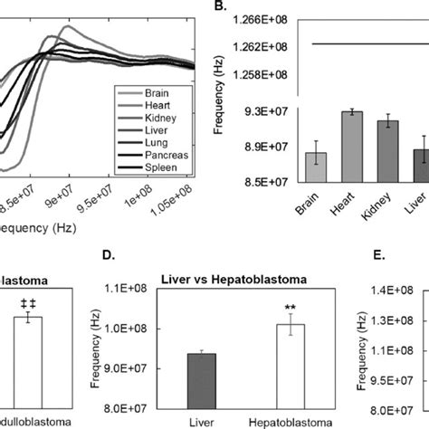 Detection Of Tumor Type Using The Lc Sensor A Scans Of Flank Tumor Download Scientific