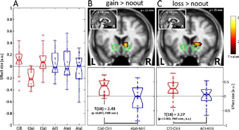 No Increase In Ventral Striatal Activation During Gain Anticipation In Download Scientific