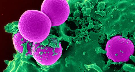 Staphylococcus Lugdunensis Un Scn Diferente De Los Demás Codeinep
