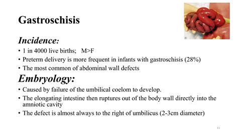 Approach To Congenital Abdominal Wall Defects Pptx