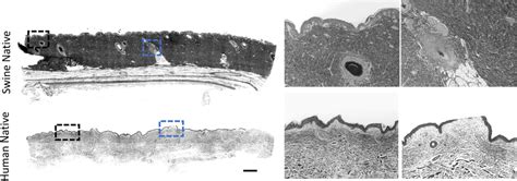 sem based visual and structural characterization of full‐thickness skin