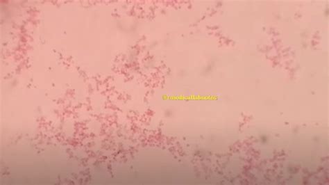 Gram Negative Cocci Gnc Bacteria Introduction List Of Bacteria