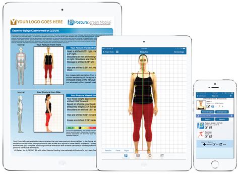 Digital Posture Analysis