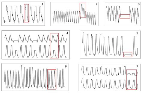 Anomaly Detection In Satellite Telemetry Data Using A Sparse Feature Based Method Anomaly Detection In Satellite Telemetry Data Using A Sparse Feature Based Method