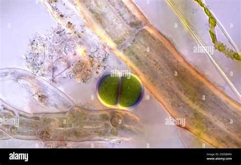 Polarised Light Micrograph Of Chroococcus Sp Cyanobacteria Between Red Alga Filaments From The