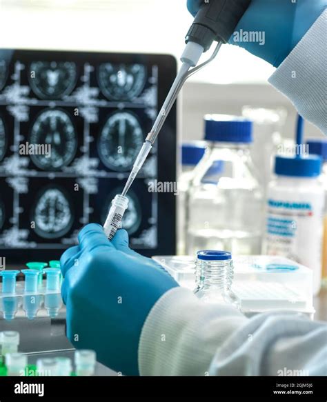 Dementia Test Hi Res Stock Photography And Images Alamy