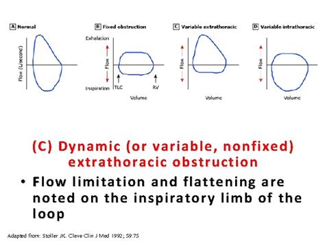 Copd Diagnosis Differential Diagnosis 1 Dr Mazen Qusaibaty