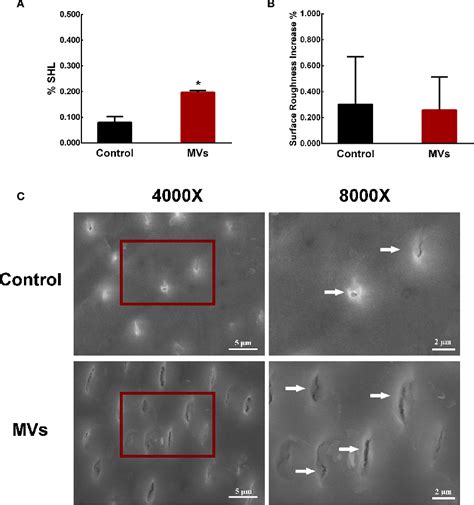 Figure 2 From Streptococcus Mutans Membrane Vesicles Enhance Candida Albicans Pathogenicity And