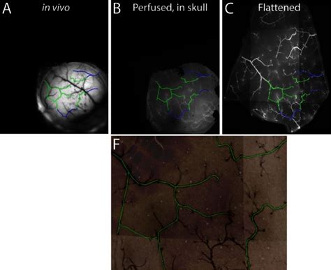 an extended retinotopic map of mouse cortex pmc