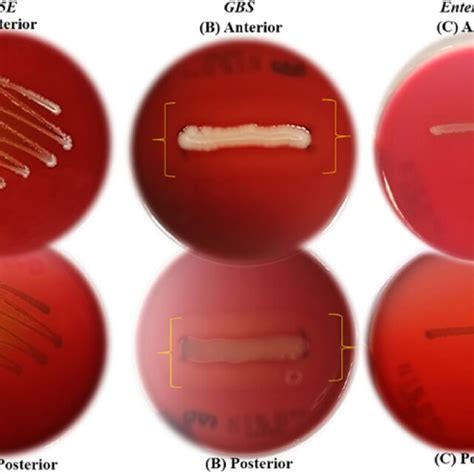 Exhibition Of Hemolysis Activity A The Anterior And Posterior