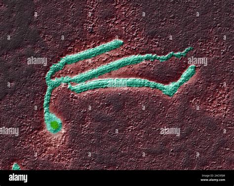 Ebola Virus Particles Coloured Transmission Electron Micrograph Tem Each Particle Consists