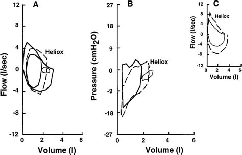 Maximal And Tidal Flow Volume And Pressurevolume Loops For Typical Download Scientific Diagram