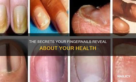 The Secrets Your Fingernails Reveal About Your Health Nailicy