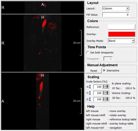 Registrationmanual — Mevislab Documentation