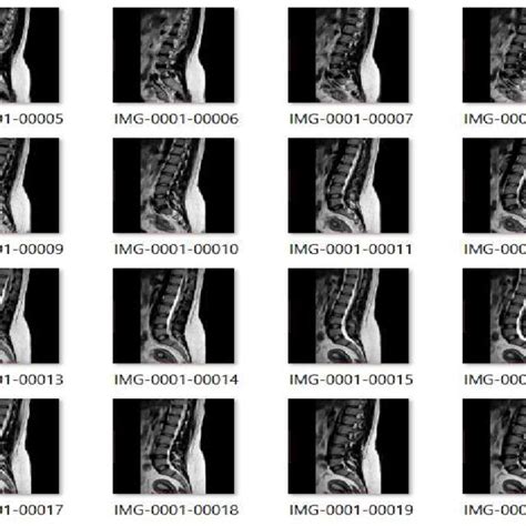 sample sci database with disease type abnormal and normal cases of