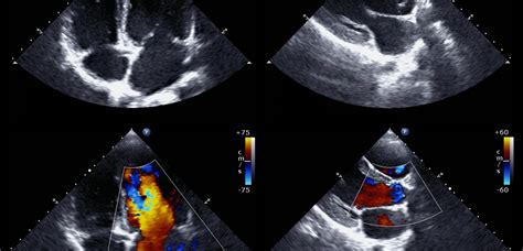 Echocardiogram Test London Phoenix Hospital Group