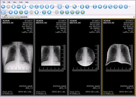 Clearcanvas Workstation Personal Edition Chinesefasr