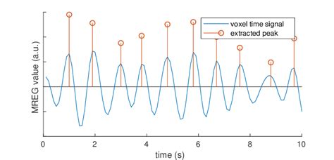 Wavefront Extraction On A Time Signal Of A Voxel Only Time Points At Download Scientific