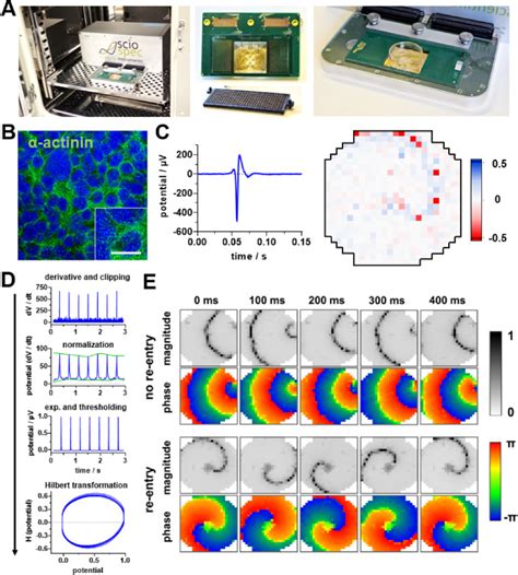 Novel High Dense Microelectrode Array Based Multimodal Bioelectronic Monitoring System For