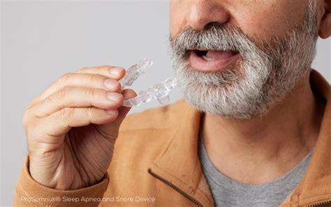 Oral Appliance Therapy Careica Health