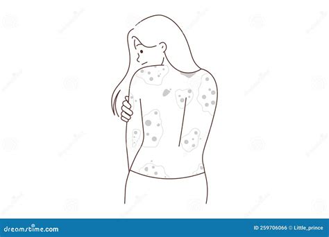 Unhealthy Woman Show Red Rash On Back Stock Vector Illustration Of Unhealthy Woman Show Red Rash On Back Stock Vector Illustration Of