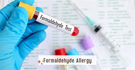 Formaldehyde Allergy Symptoms Treatment Household Items