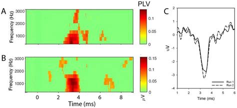 Figure 4 From Complementary Metrics Of Human Auditory Nerve Function