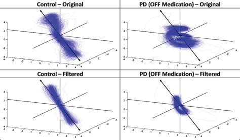 Triaxial Angular Velocities Radians Second Recorded From The Right