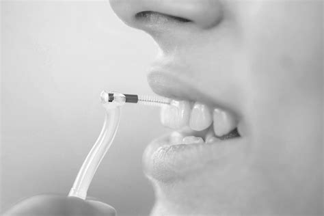 Interdental Brushing Hamworthy Dentist Poole