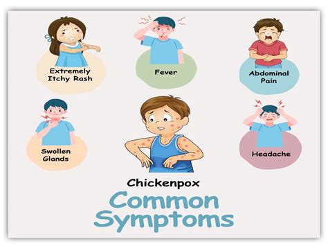 Case Presentation On Chickenpox Ppt Chn Pptx