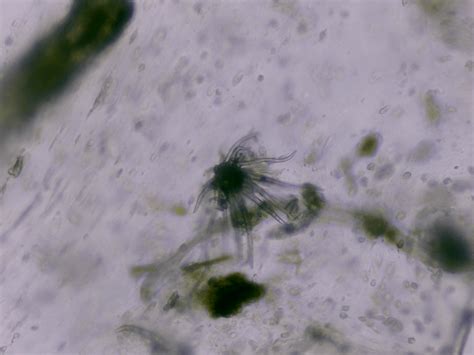 At 2500x The Mucus Ball That Formed In My Throat Has A Chaetogaster In