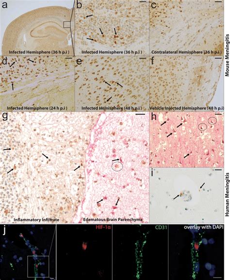 Induction Of Hif 1α In Mouse And Human Brain Tissue Samples From Download Scientific Diagram