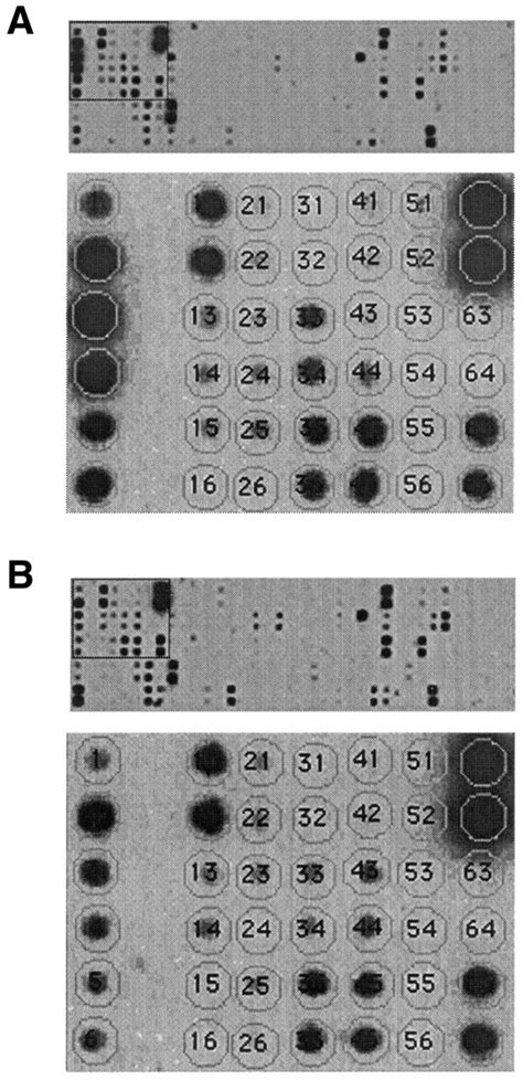 Dna Arrays Were Used To Confirm Differential Gene Expression Profiles
